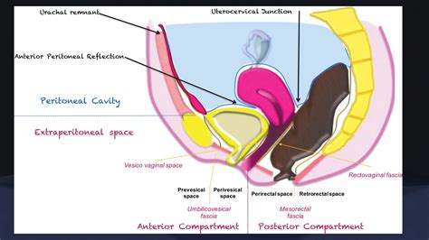 Pelvic Anatomy Mri Of Male And Female Pelvispptx