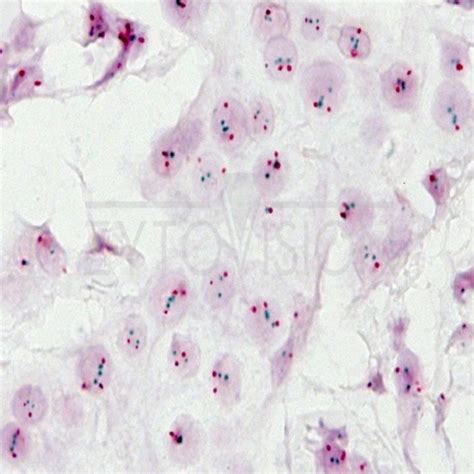 Her2 Cen 17 Dual Cish Detection Kit Zytovision Technology شرکت سما تشخیص آریا