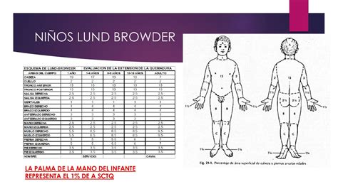 17 Quemaduras 2021 Speaker Deck
