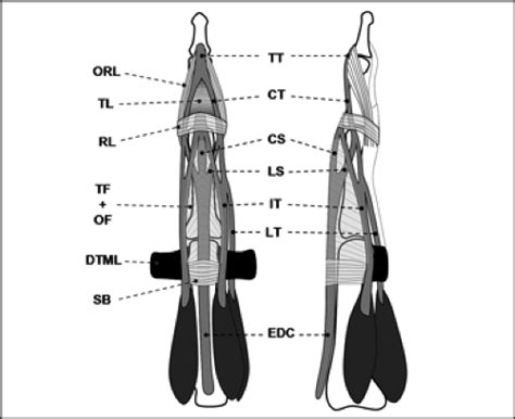 Extensor Tendon Injuries Of The Finger Radsource