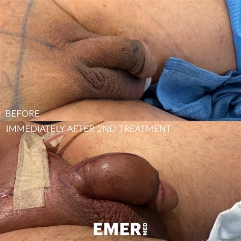 254021 Jason Emer Male Clinic