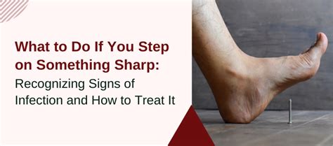What To Do If You Step On Something Sharp Recognizing Signs Of