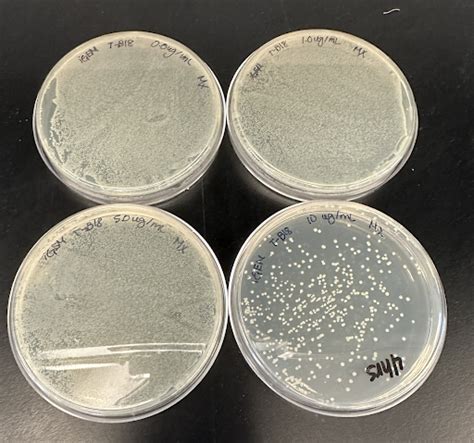 Igem Toronto