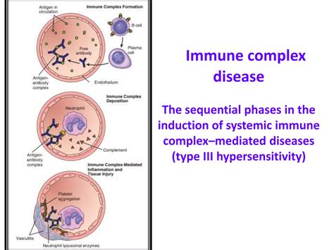 Disease Of Immune System Lecture 7 Pptx