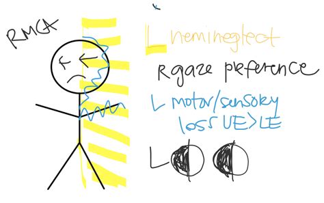 Stroke Mimics A Review Sinai Em