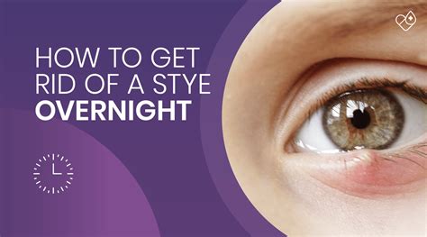 How To Get Rid Of A Stye Overnight Dryeye Rescue