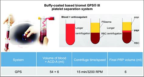 Gps Kit Of Biomet Ppp Plateletpoor Plasma Prp Platelet Rich Plasma