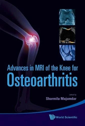 Ehsan Saadat Advances In Mri Of The Knee For Osteoarthritis Relié Eur 14100 Picclick Fr