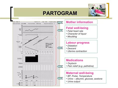 Partogram Ppt