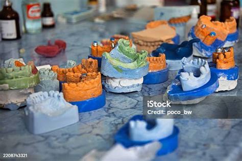 The Plaster Model Of The Jaws Dental Prosthesis Dentures Prosthetics