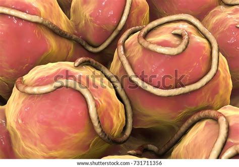 Helminths Nematodes Enterobius Gut Threadworm Which Stock Illustration