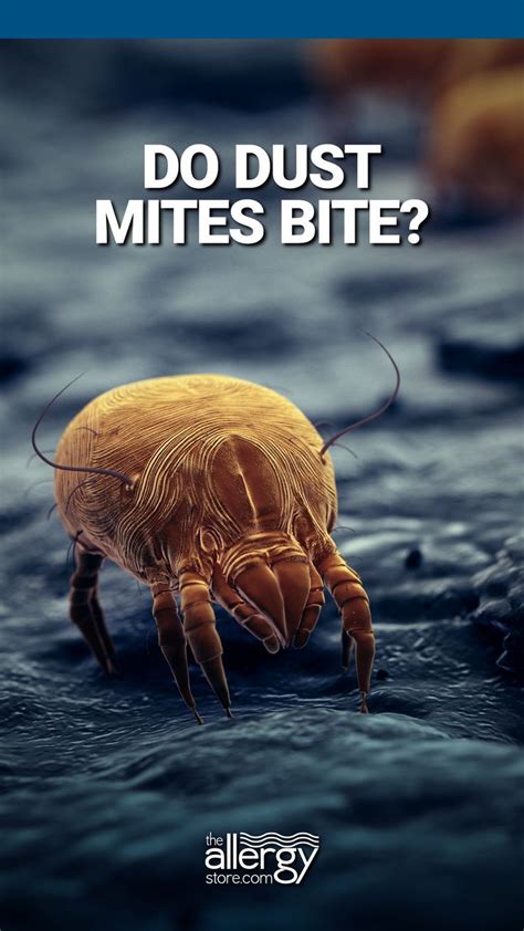 How To Prevent And Treat Chigger Bites Artofit