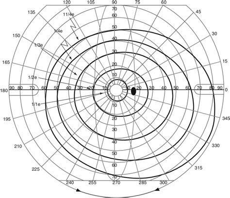 6 Kinetic Perimetry Results For The Right Eye Of A Patient With A