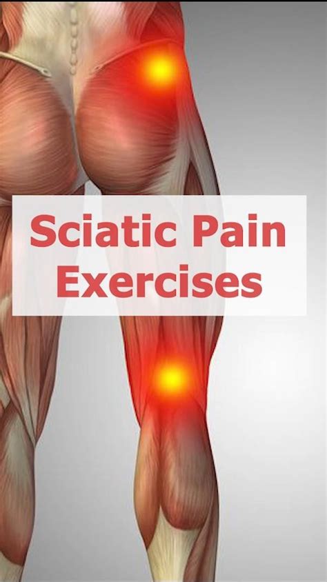 Best 13 Sciatica Recover In 3 Simple Steps Artofit