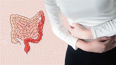 Stem Cell Treatment For Ulcerative Colitis Delhi India Stem Cell