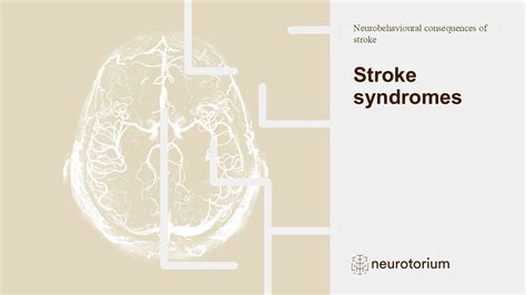 Neurobehavioural Consequences Of Stroke Stroke Syndromes Neurotorium