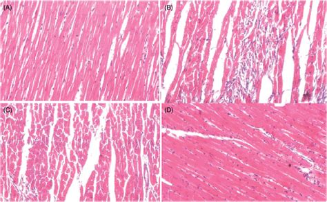 Myocardium Tissue