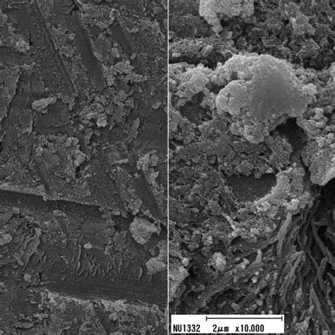 Representative Sem Micrograms Of Dentin Smear Layers Dentin Surface