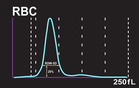 Rdw Sd Alto E Basso Cosa Indica
