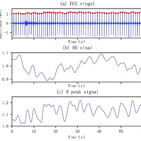 positioned r peak and extracted derived rr interval signal and r peak