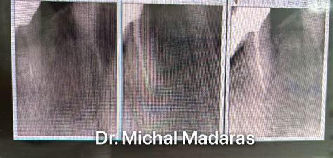 Michal Madaras On Linkedin Bypass Of Broken File Michal Madaras On Linkedin Bypass Of Broken File