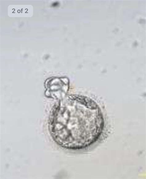 4 Bb But Its Hatching Rembryologists