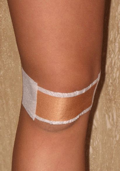 Medial Patellar Glide Taping Download Scientific Diagram