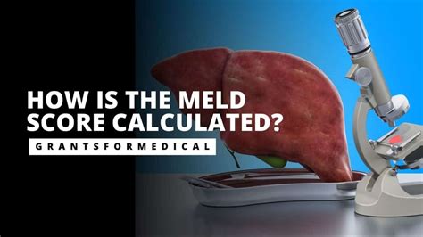 What Is The Meld Score Why Is The Meld Score Used