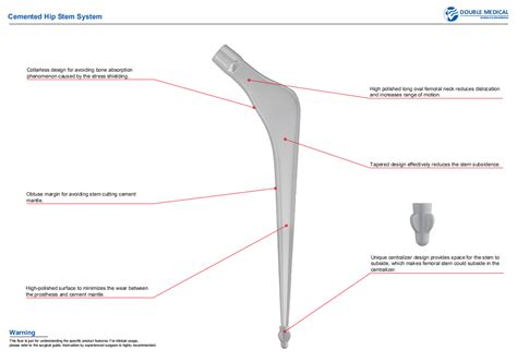 Cemented Hip Stemmedical Device Manufacturers Double Medical