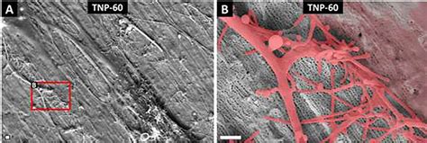 Surface Topography Titanium Implant Ijn
