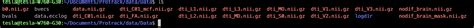 使用fsl对dti进行概率纤维追踪（gpu版本） fsl dti csdn博客