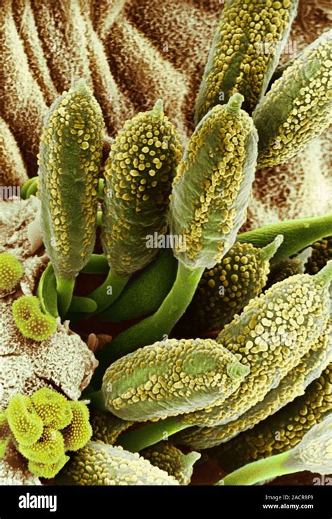 Rust Fungus On A Rose Leaf Coloured Scanning Electron Micrograph SEM Of Rust Fungus