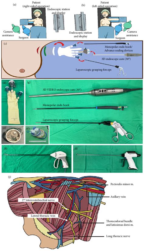 Single Port Three Dimensional Endoscopic Assisted Axillary Lymph Node