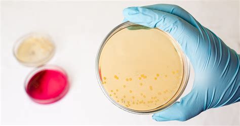 Staphylococcus Aureus Testing Market Set To Reach Usd 6 9 Billion By 2033 At A 5 3 Of Cagr