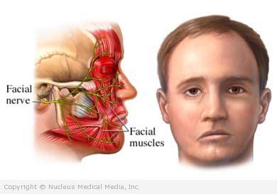 Bells Palsy Description Diagnosis Treatment Brain And Nerves