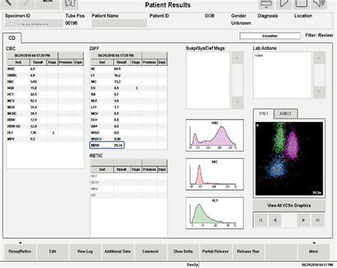 Monocyte Distribution Width Beckman Coulter