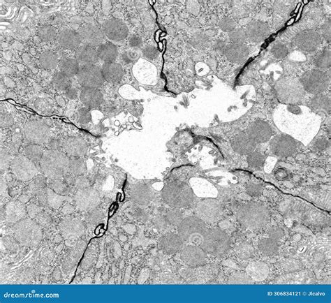 Epithelium Intercellular Space Stock Image Image Of Lanthanum Ultrastructure 306834121
