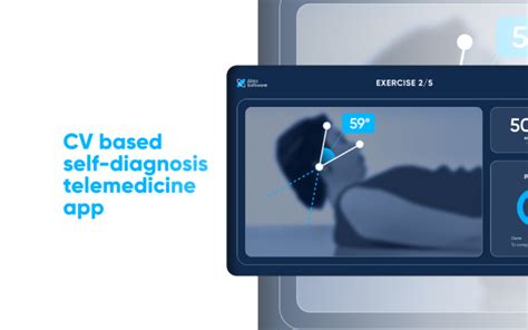 computer vision based self diagnosis telemedicine app abto software