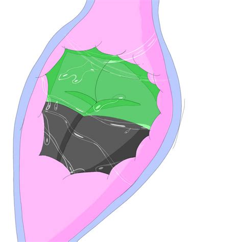 Tsuyu Asui Tail Vore X Ray By Ricardoarts935 On Deviantart