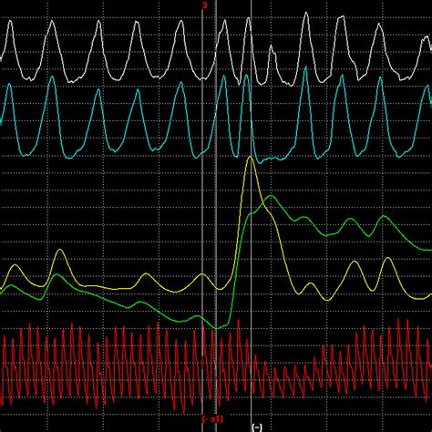 Is A Polygraph A Reliable Lie Detector