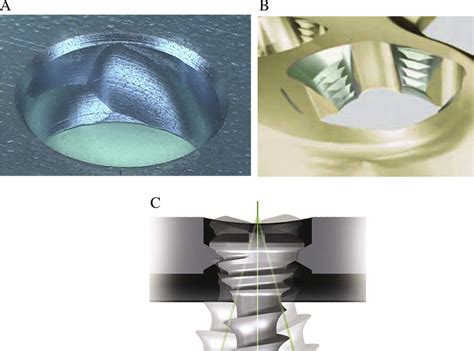 A Locking Mechanism With Three Points Wedged Hole And Screw Threads B Download Scientific