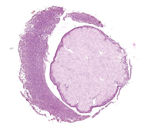 Hypophysis Diagram Quizlet