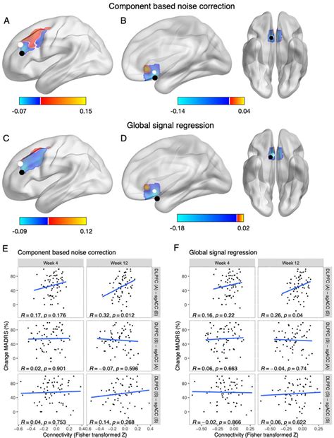 Brain Images Panel A D Were Visualized With Brainnet Viewer Xia Et Download Scientific
