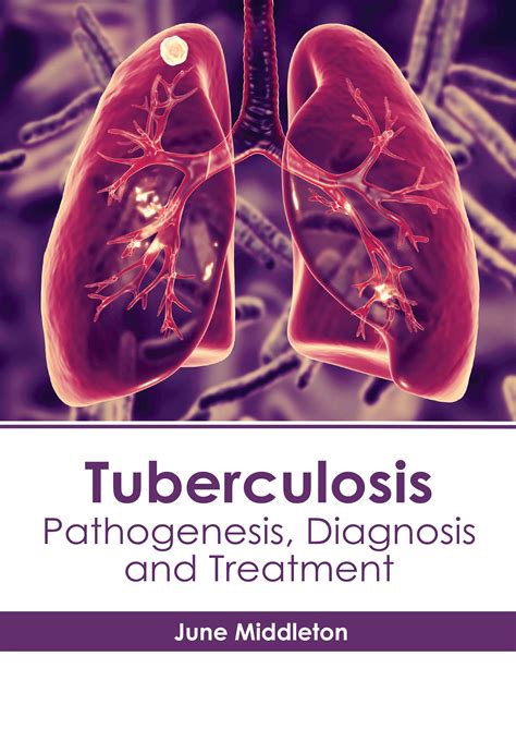 Tuberculosis Pathogenesis