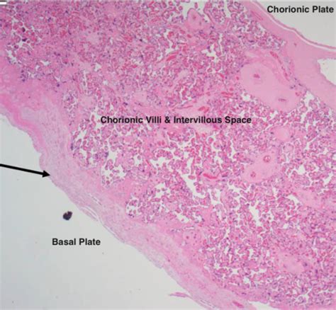 Chorionic Villi Histology Labeled