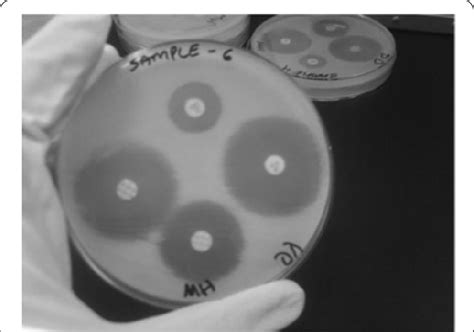 Double Disc Diffusion Test Download Scientific Diagram
