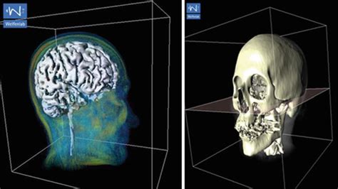 4 3d Segment Visualization And Isosurface Rendering Using Marching Cube Download Scientific