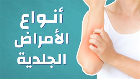 أنواع الأمراض الجلدية فيديو Dailymotion