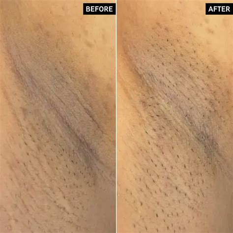 Glycolic Acid Exfoliating Body Stick The Inkey List