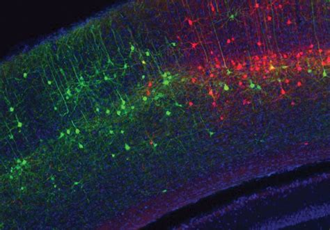 engineered rabies virus illuminates neural circuitry the scientist